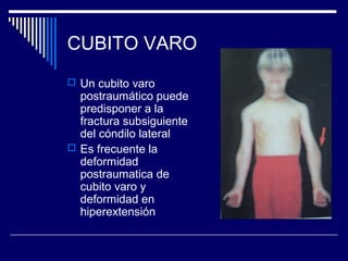 Cubito varo | PPT