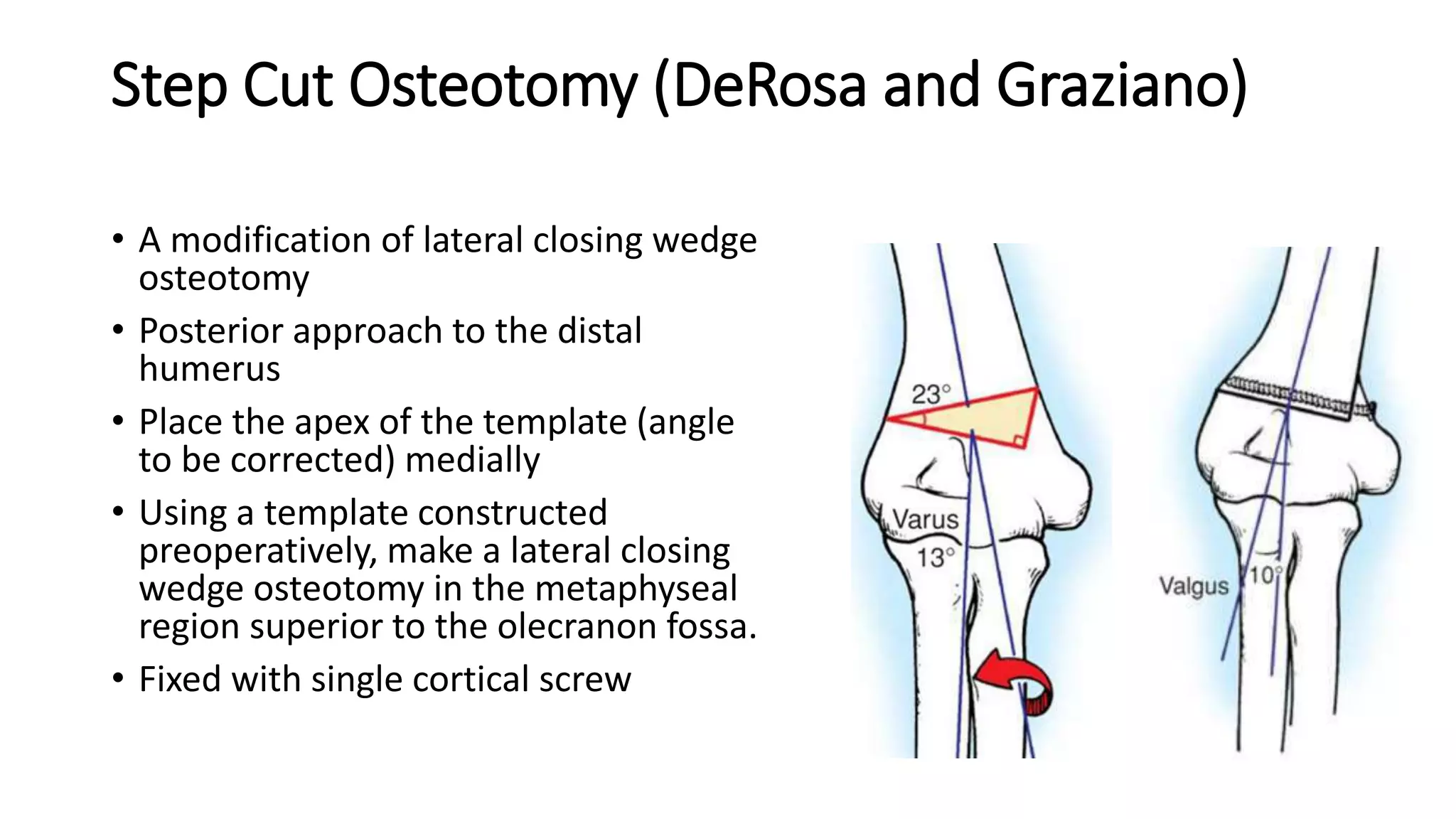 Cubitus valgus varus | PPTX