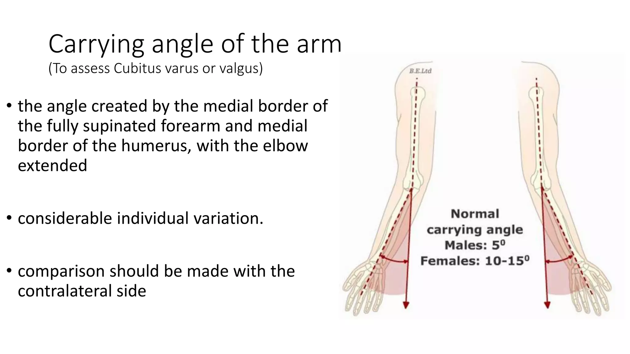 Cubitus valgus varus | PPTX