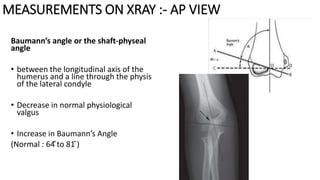 Cubitus valgus varus | PPTX
