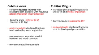 Cubitus valgus varus | PPTX