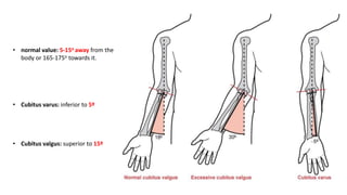 Cubitus valgus varus | PPTX