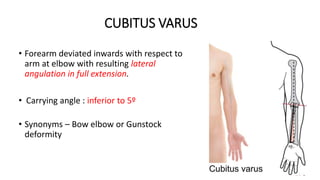 Cubitus Valgus And Cubitus Varus