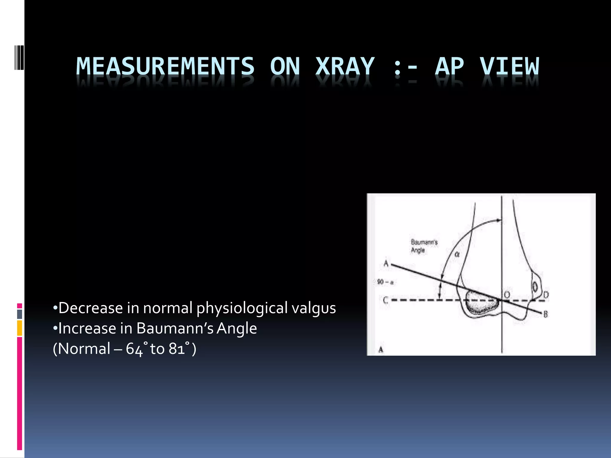 Cubitus varus by Dhrumil Patel | PPTX