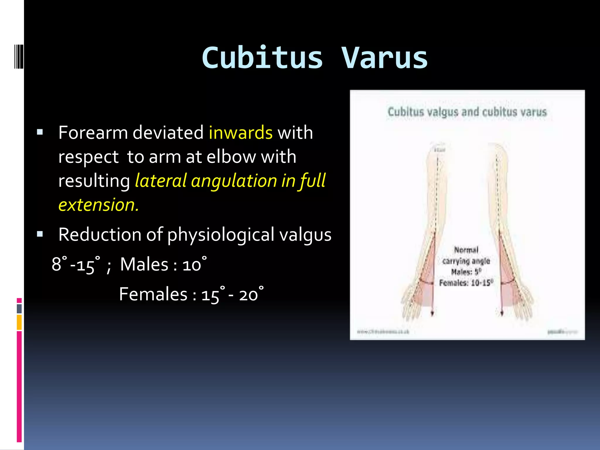 Cubitus varus by Dhrumil Patel | PPTX