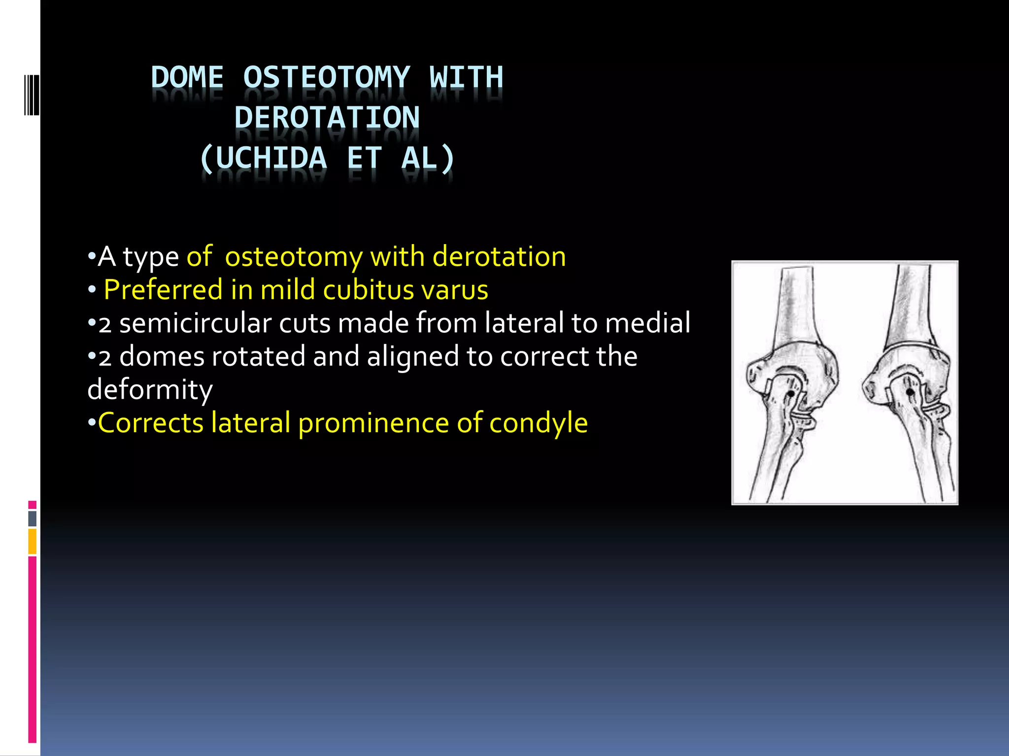 Cubitus varus by Dhrumil Patel | PPTX