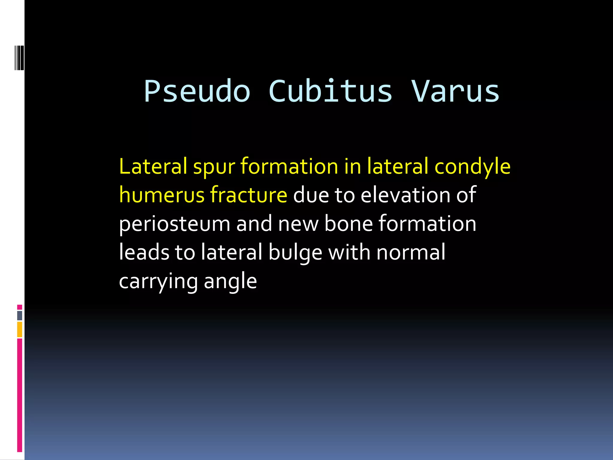 Cubitus varus by Dhrumil Patel | PPTX