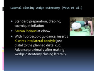 Cubitus varus by Dhrumil Patel | PPTX