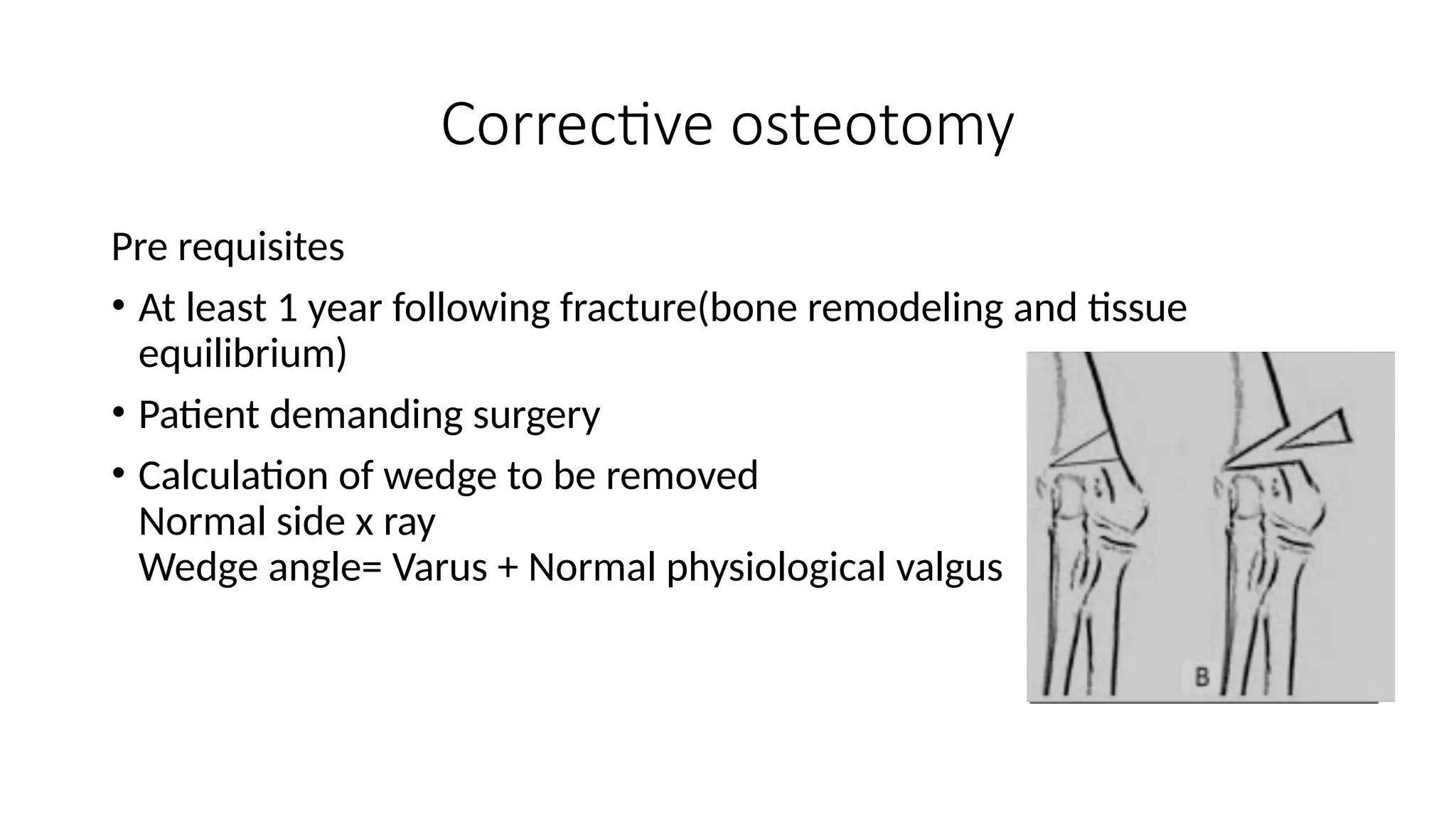 CUBITUS VARUS AND VALGUS DEFORMITY .pptx
