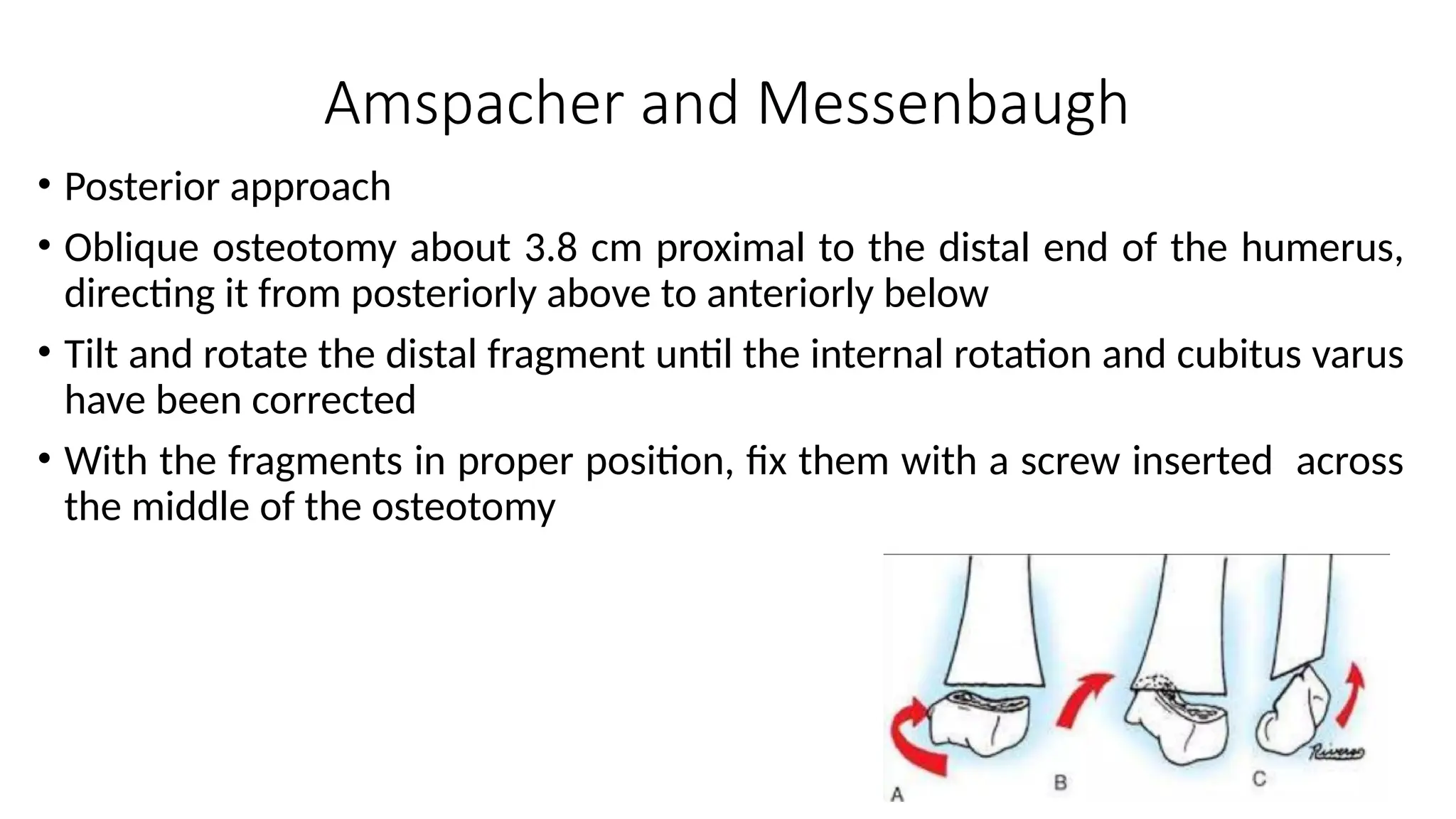 CUBITUS VARUS AND VALGUS DEFORMITY .pptx
