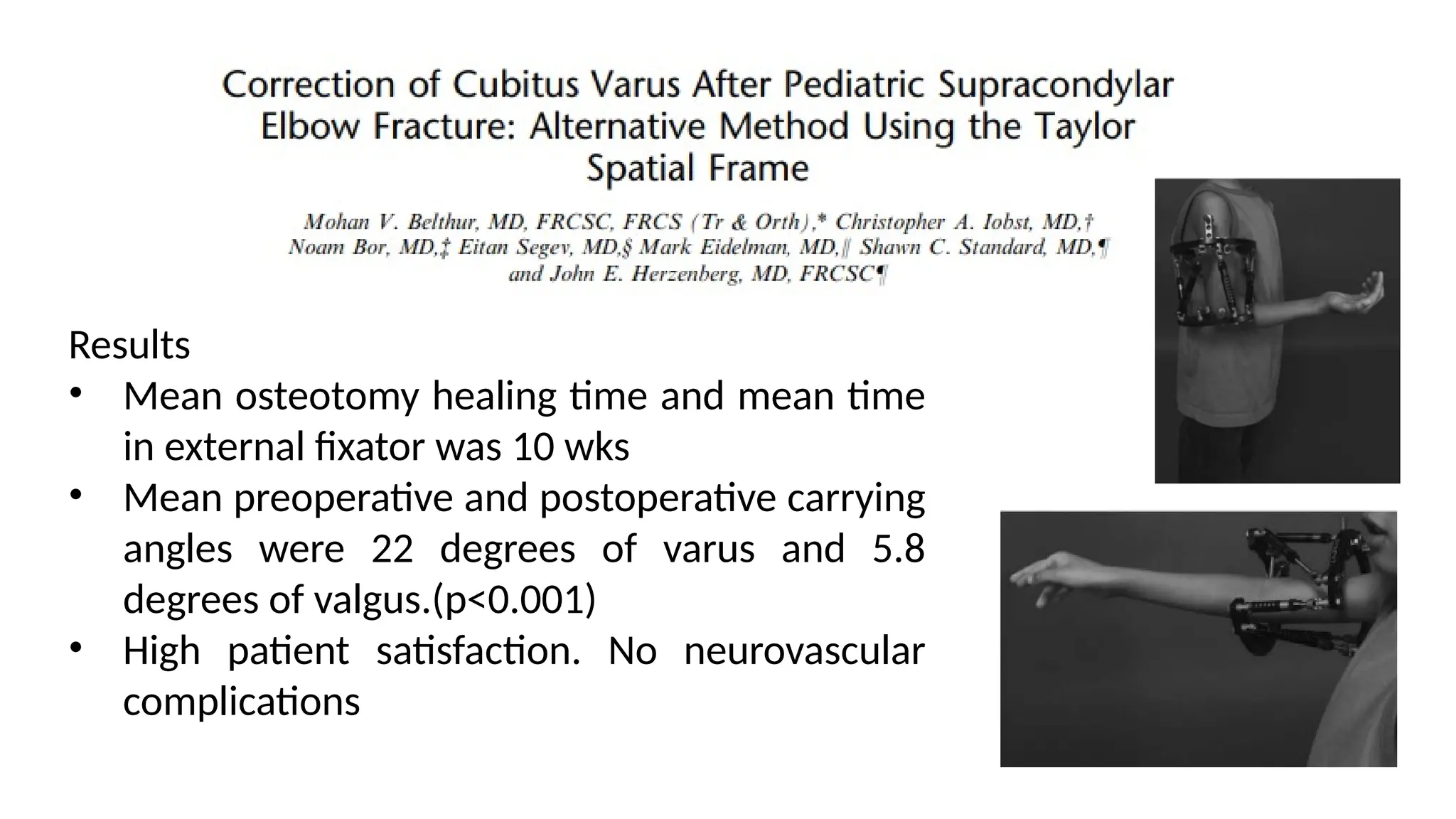 CUBITUS VARUS AND VALGUS DEFORMITY .pptx
