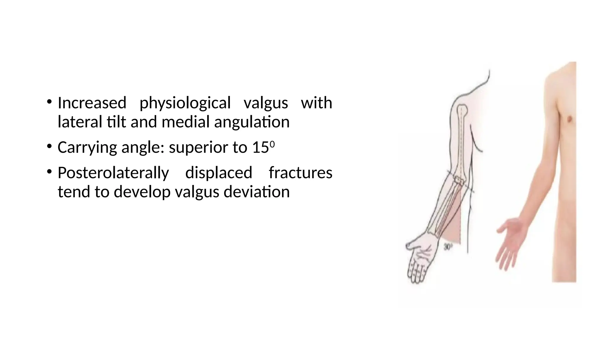 CUBITUS VARUS AND VALGUS DEFORMITY .pptx