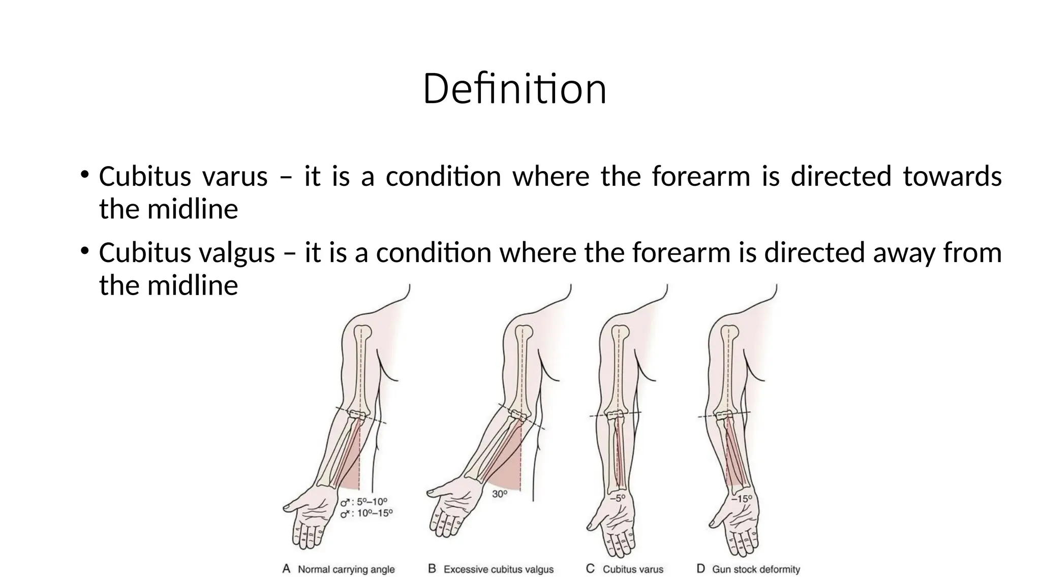 CUBITUS VARUS AND VALGUS DEFORMITY .pptx