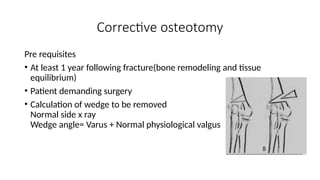 CUBITUS VARUS AND VALGUS DEFORMITY .pptx