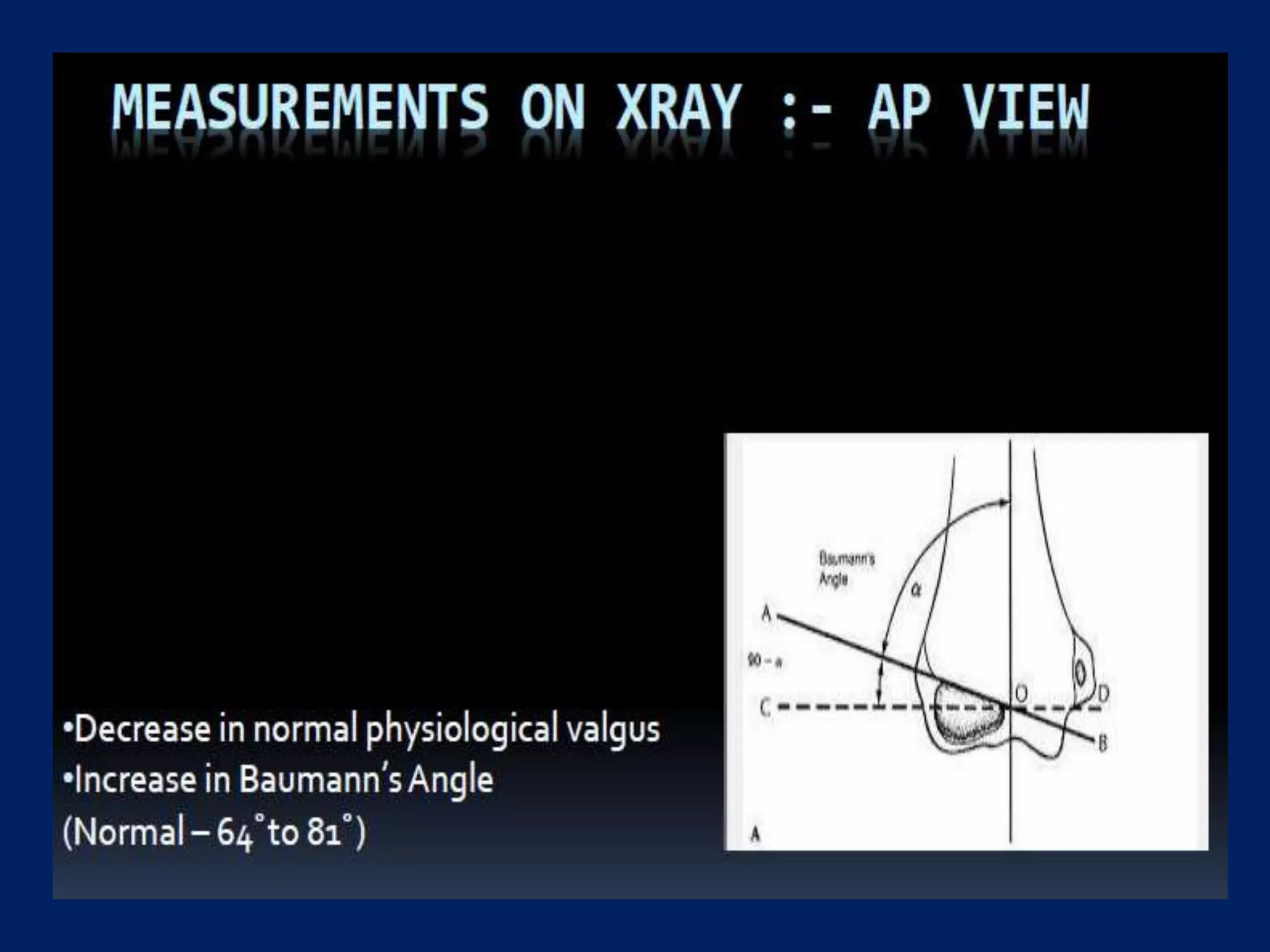 Cubitus varus deformity | PPTX