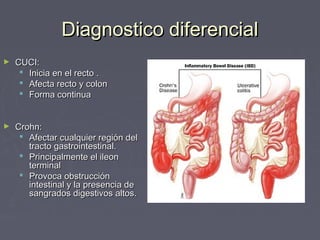 CUCI | PPT