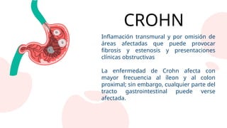 CUCI CROHN ENFERMEDAD INFLAMATORIA INTESTINAL.pptx