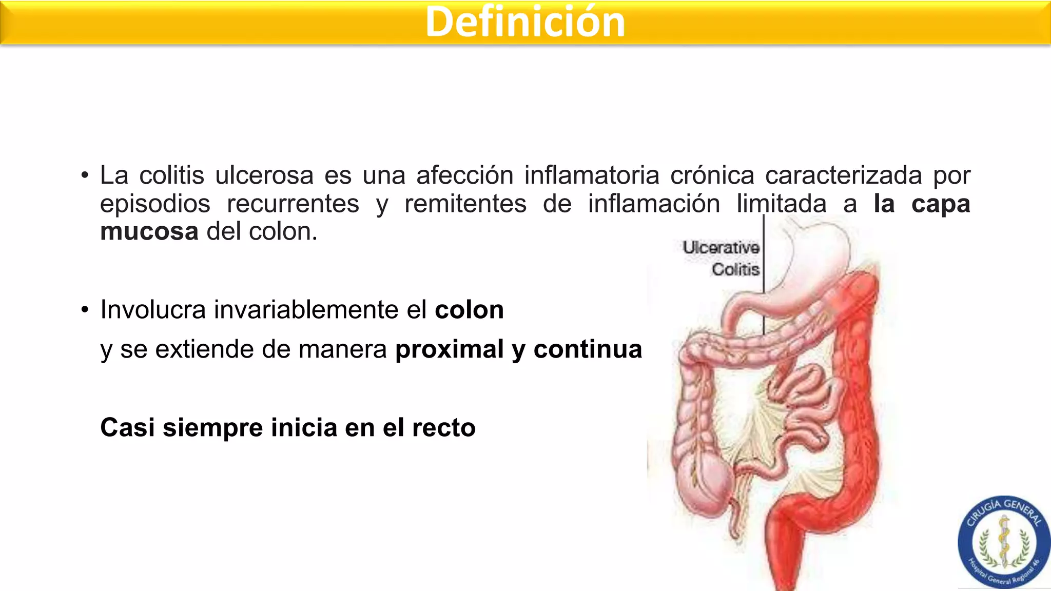 CUCI y Enfermedad de Crohn | PPTX