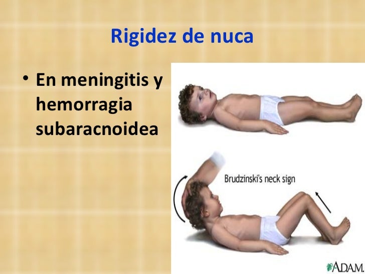 Cuello