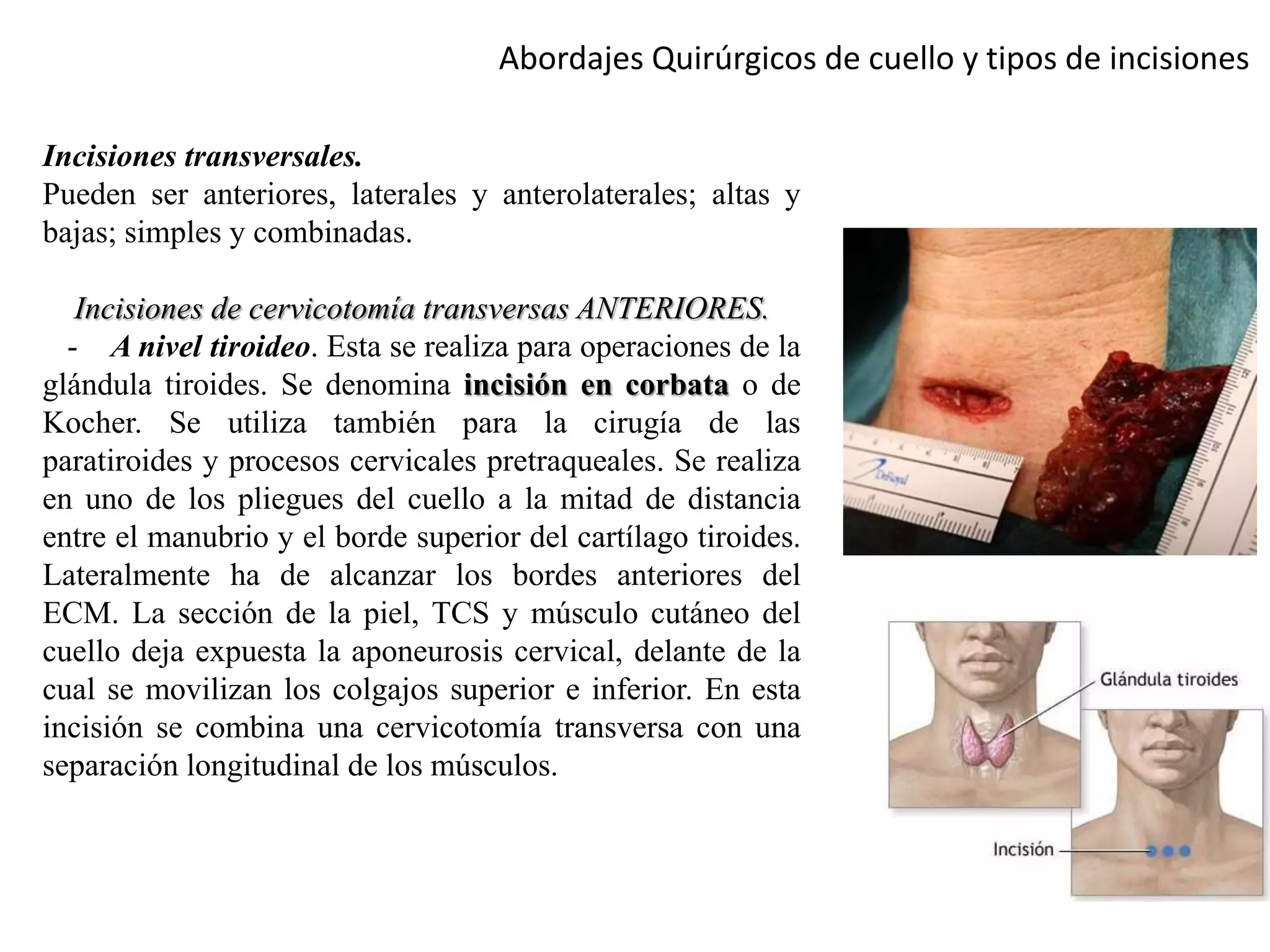 cuello.pptx