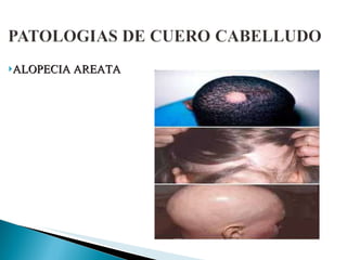 Semiologia Quirurgica Artiles (Cuero cabelludo) | PPT