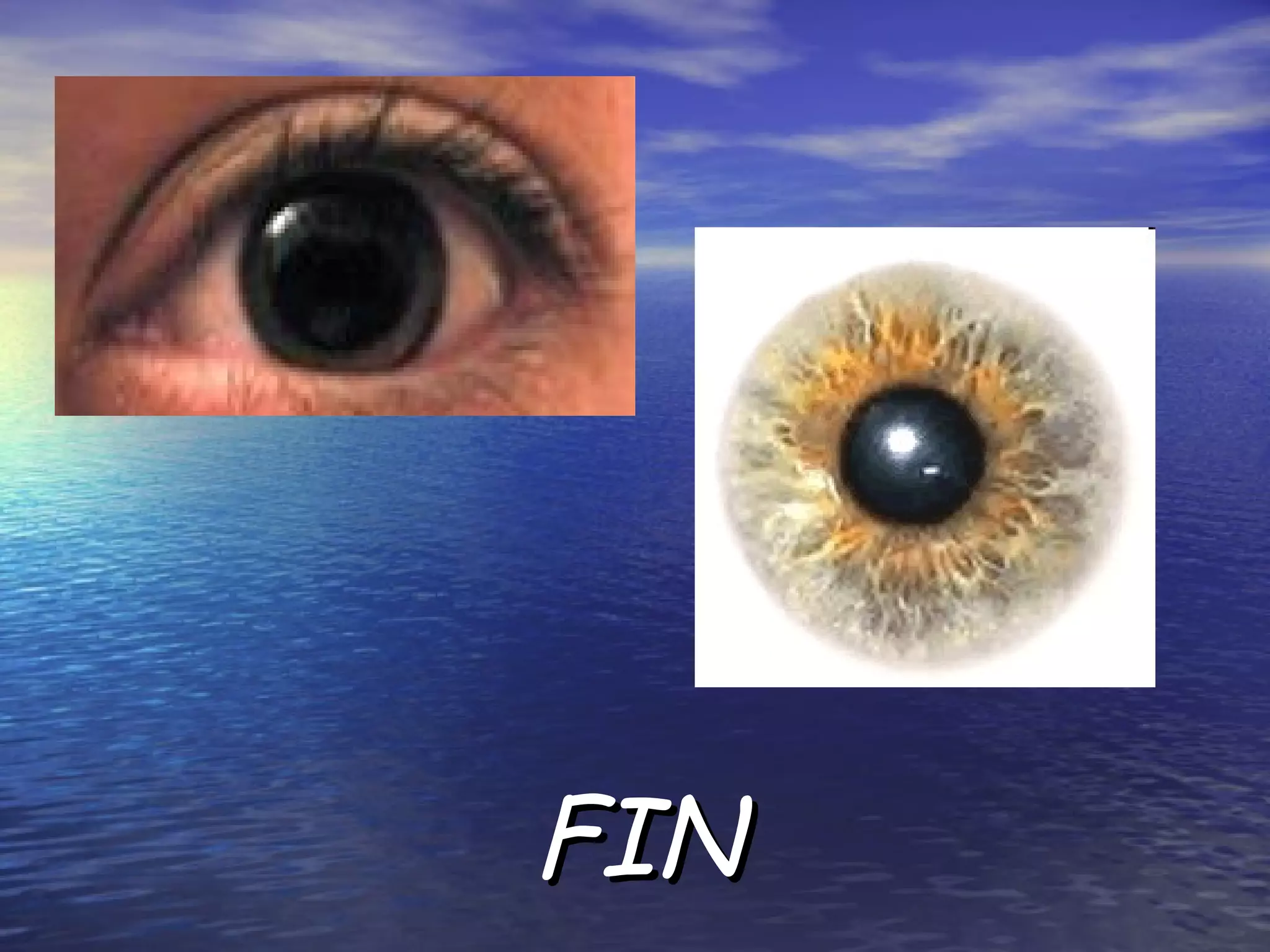 Cuerpo ciliar e iris | PPT