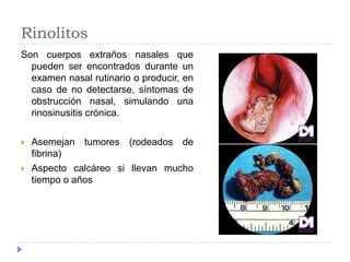 Cuerpo extraño en nariz | PPTX