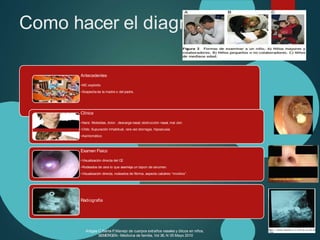 CUERPO EXTRAÑOS.pptx
