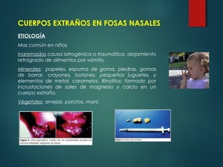 CUERPOS EXTRAÑOS EN OTORRINOLARINGOLOGIA | PPT