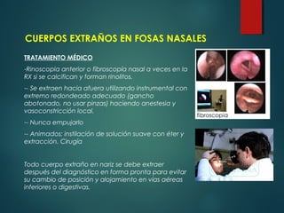 CUERPOS EXTRAÑOS EN OTORRINOLARINGOLOGIA | PPT