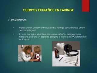 CUERPOS EXTRAÑOS EN OTORRINOLARINGOLOGIA | PPT