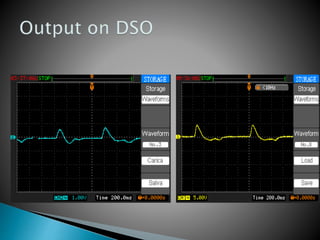 Cuffless blood pressure monitoring project | PPTX