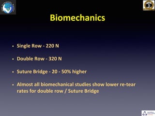 Arthroscopic Rotator Cuff Repair | PPTX