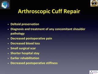 Rotator Cuff Repair, Arthroscopy, Techniques, Shoulder, Sports Injury ...