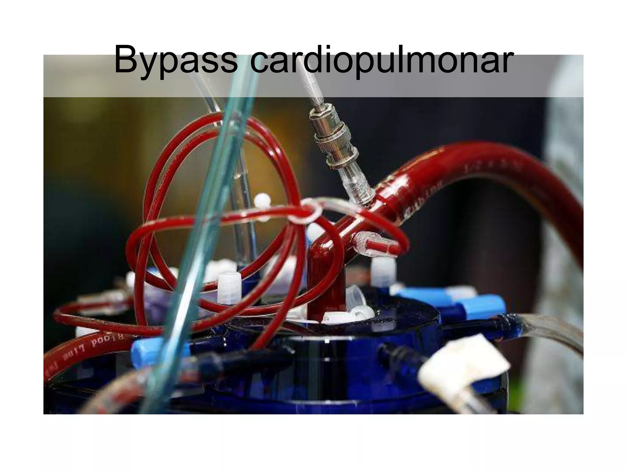 Critical postoperative care of the cardiac surgery patient | PPT