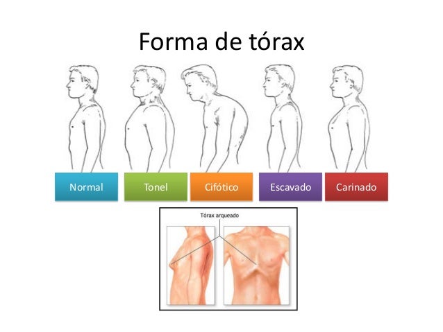 Cuidado de enfermeria en la valoracion de torax