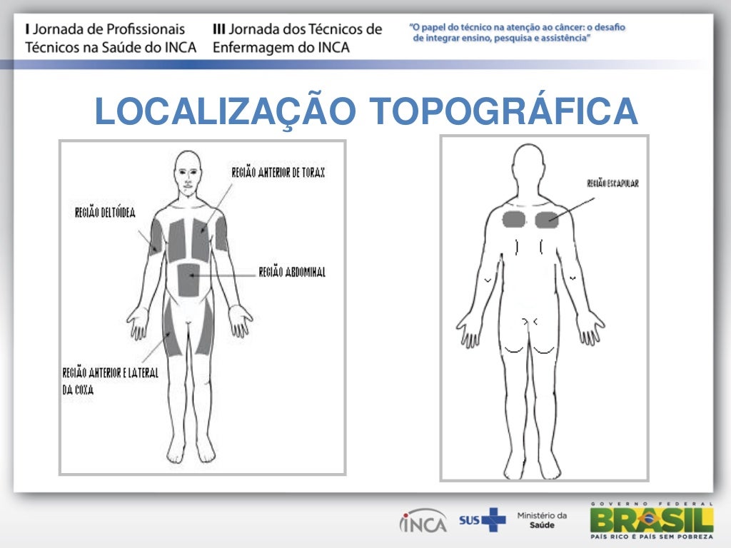 Cuidado enfermagem na terapia subcutanea