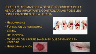 Cuidado y manejo de heridas Post operatorias.pptx