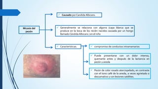 Cuidados de-enfermería-durante-la-lactancia-materna | PPTX