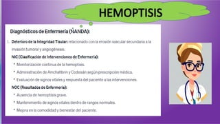 emergencia oncologica HEMOPTISIS PULMONAR | PPTX