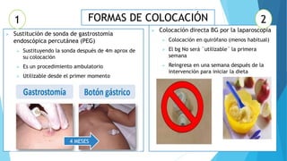 CUIDADOS DE ENFEMERIA EN PACIENTES PORTADOR DE GASTROSTOMIA.pptx