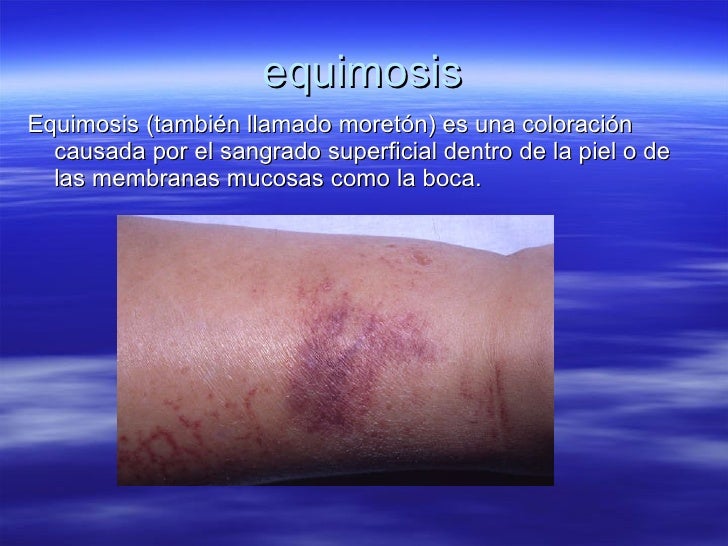 Cuidados de enf. en oncologia (2)