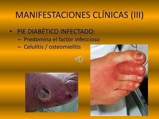 CUIDADOS DE ENFERMERÍA EN EL pie diabetico.pptx