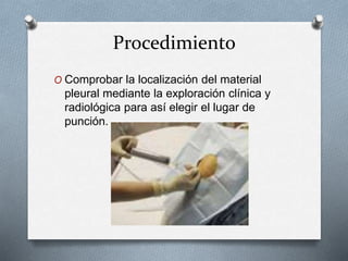 Cuidados de enfermería en toracocentesis | PPTX