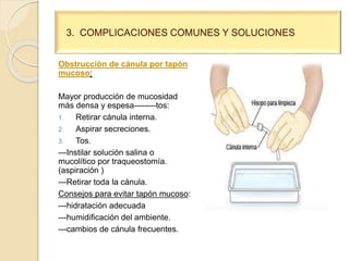 Cuidados de enfermeria al paciente con traqueostomía | PPTX