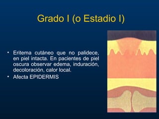 Cuidados de enfermeria en UPP | PPT