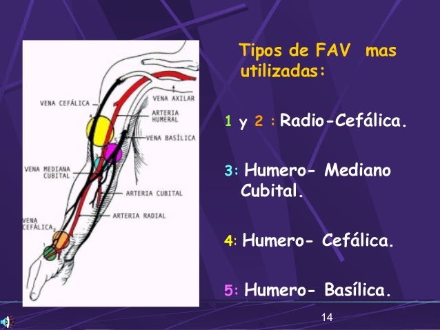 Cuidados en accesos vasculares upch
