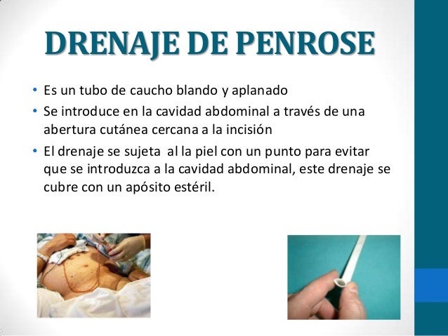 Cuidados Generales De Enfermería En Quirurgícas