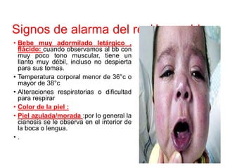cuidados mediatos del recien nacido.pptx