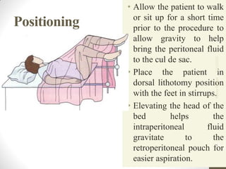 culdocentesis.pdf